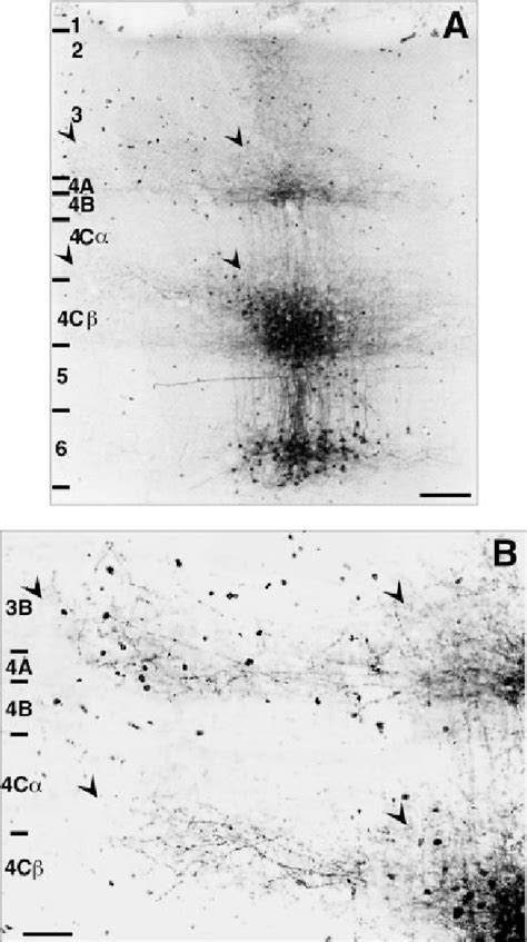 a biocytin injection in layer 4cα under an inter blob region of