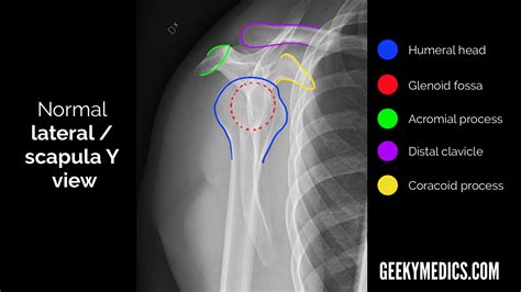 Shoulder X Ray Interpretation Radiology Geeky Medics