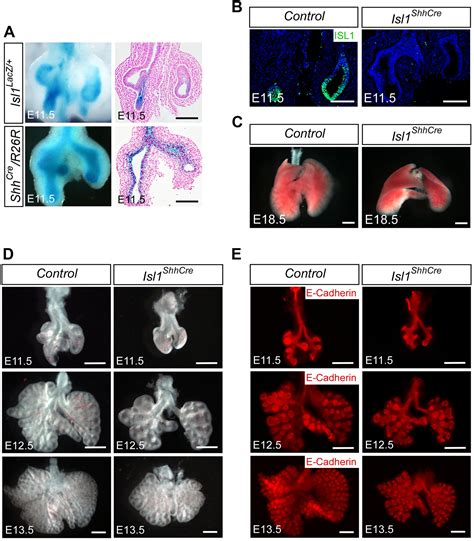 Isl1 Regulates Lung Branching Morphogenesis Via Shh Signaling Pathway
