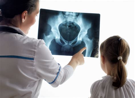Are X Rays Harmful For Your Body New Health Advisor