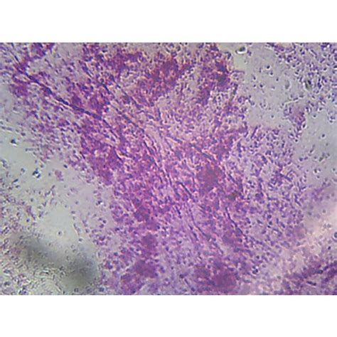 Prepared Microscope Slide Pseudomonas Aeruginosa Smear