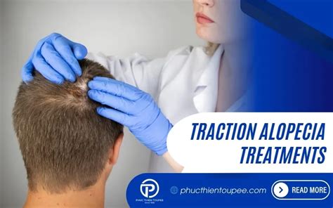 Traction Alopecia Treatments Restore Your Hairline And Confidence Phuc