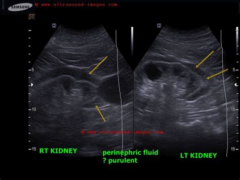 A Gallery Of High Resolution Ultrasound Color Doppler And 3d Images