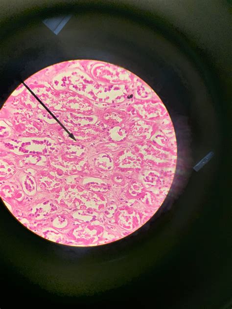 Simple Squamous Squamous Molecular Biology Simple