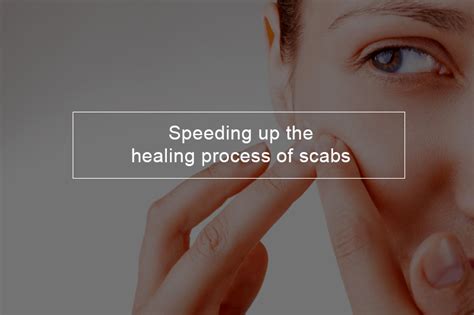 How Long Does A Scab Take To Heal Stopyourskinproblem Com