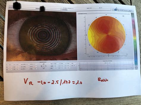 17 Cc77 E2 009 A 45 E1 B9 Ee 2 D3 A478 B24 A3 Hosted At Imgbb — Imgbb