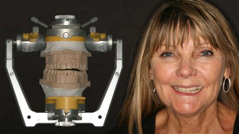 Case Study Tmj Splint Therapy Success For The Tmd Patient