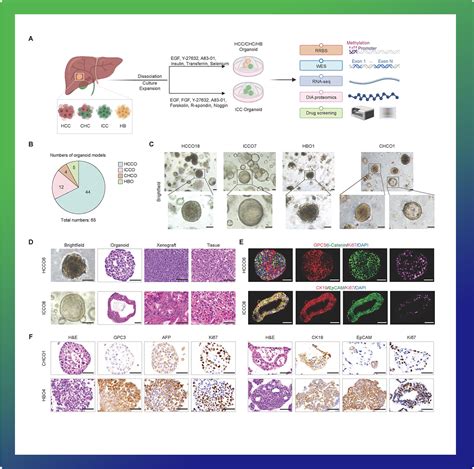 Science Translational Medicine 肝癌类器官模型库实现药物精准筛查 文章发表 丹望医疗 类器官技术的领导者