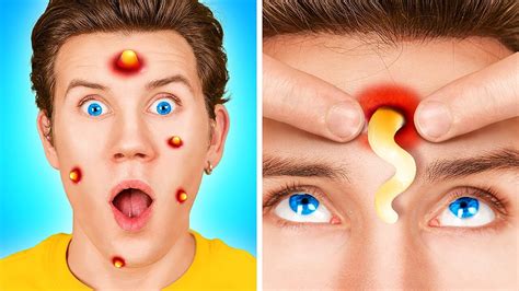 NEVER POP PIMPLES Extreme Nerd Makeover Into The K POP Crush With TikTok Gadgets By GO