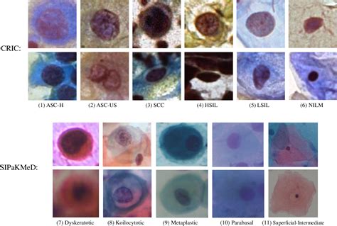Figure From CVM Cervix A Hybrid Cervical Pap Smear Image Classification Framework Using CNN