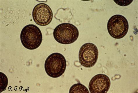 Taenia Pisiformis Adult