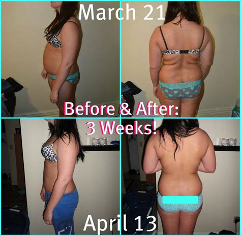 The Bloated Bride Before After Pictures 3 Weeks