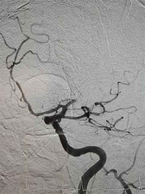 Manoj Mahata On Linkedin Tici 3 Flow Achievedred 62 Aspiration Only