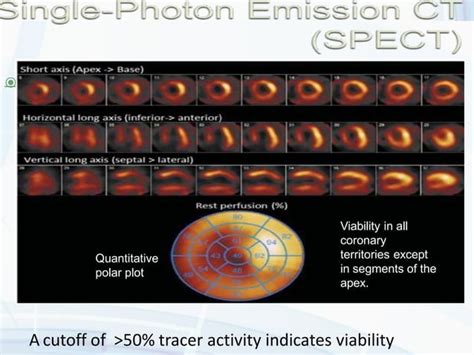 Coronary Classpptx Free Download