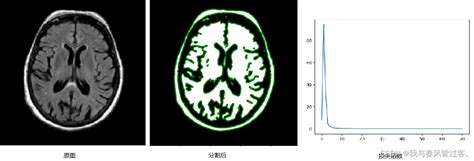基于水平集lbf模型的图像边缘轮廓分割凸优化 split bregman分裂布雷格曼算法的最优解 csdn博客