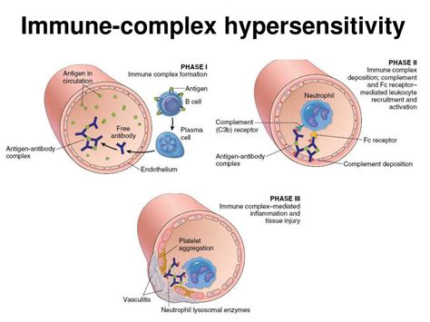 Ppt Understanding Immune Responses Hypersensitivities And Allograft