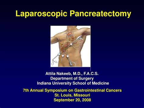 PPT - Laparoscopic Pancreatectomy PowerPoint Presentation - ID:447449