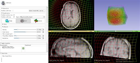 How To Apply A BSpline Transformation Field Produced By A Registration To Another Volume Image