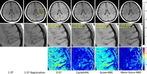 meta learning enabled score based generative model for 1 5t like image
