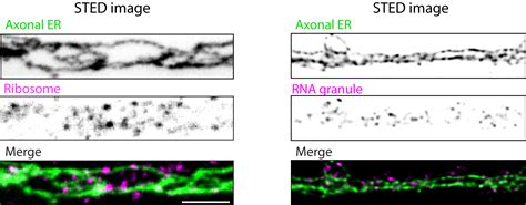 Neuronal Mrna Trafficking And Local Translation Cncr