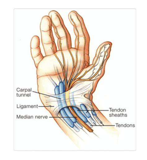 Carpaal Tunnel Syndroom Cts Tothepoint Therapie