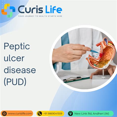Peptic Ulcer Disease Pud Treatment In Andheri West Curis Life Clinic
