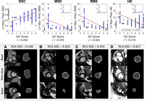 Rca Application On 7250 Cardiac Mri Segmentations Of Ukbb Imaging Download Scientific Diagram