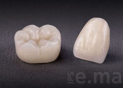 Kurora Full Porcelan E Max Dentaristo