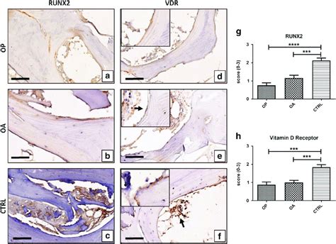 Runx2 And Vdr Expression Immunohistochemical Results Were Evaluated By