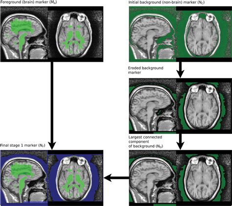Frontiers Brain Extraction Using The Watershed Transform From Markers