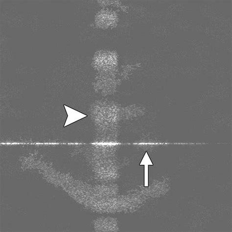 calibration scan mri at mabel burton blog