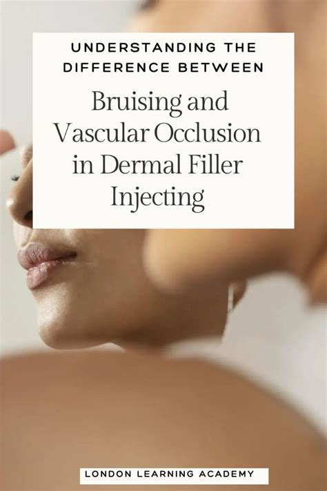 Understanding The Difference Between Bruising And Vascular Occlusion In