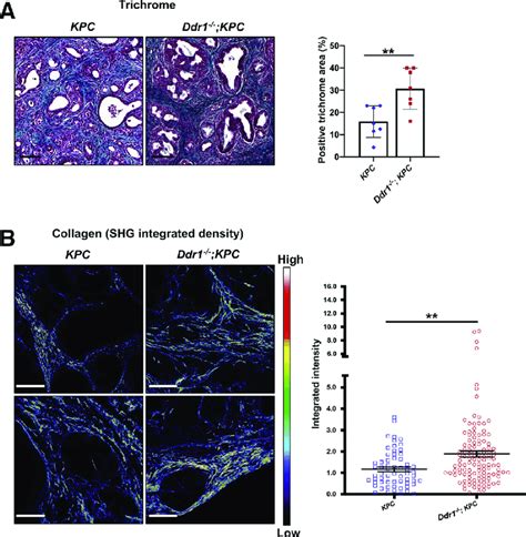 The Absence Of Discoidin Domain Receptor 1 Ddr1 Alters The Fibrotic