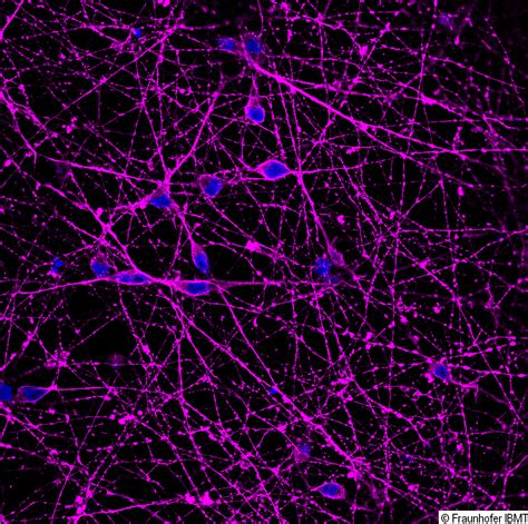 Ipsc Derived Neuronal Cell Product Scientist Live
