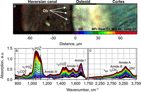 Ftir Absorption Spectra Of Bone Tissues Representative Of Variation