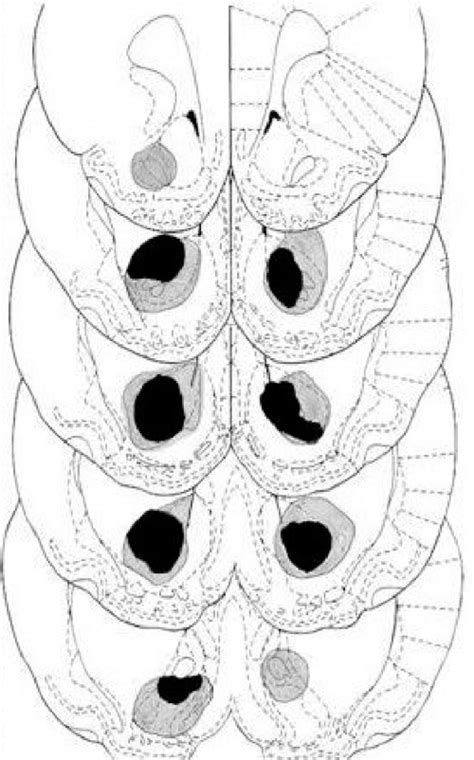Figure 2 From The Role Of The Nucleus Accumbens Core In Impulsive Choice Timing And Reward