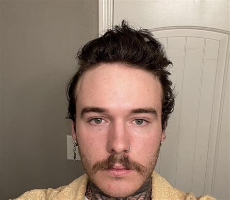 Almost 3 Months Post Op Fdl Abdominoplasty Doing Some December Bikini