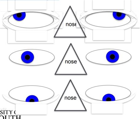 Compensatory Head Postures And Alphabet Patterns Flashcards Quizlet