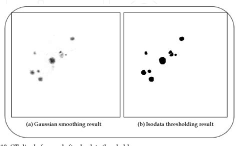 Figure 1 From Fully Automatic Technique For Liver Segmentation From Abdominal Ct Scan With