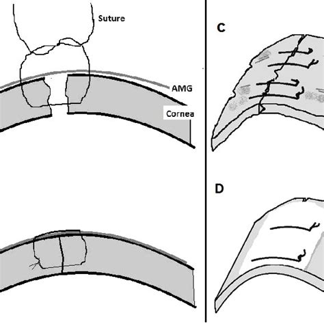 Corneal Staining Grading Areas 1 Central 2 Nasal 3 Temporal Download Scientific Diagram