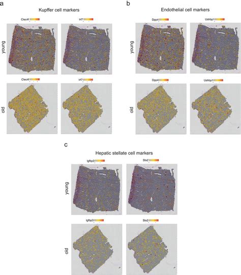 Non Parenchymal Cells In The Spatial Transcriptomics Download Scientific Diagram