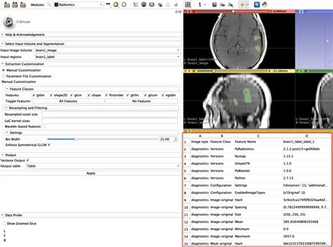 影像组学之pyradiomics以及slicer Radiomics模块介绍 经验分享 3dslicer中文论坛