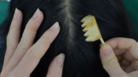 ASMR Attentive Scalp Check / Scalp Scratching Real Person For Relaxation - YouTube