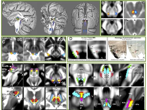 Research The Brainstem Imaging Laboratory