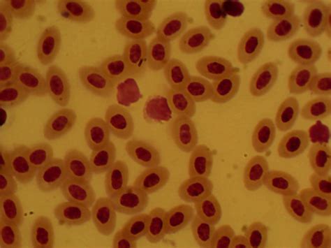 Chicken Cells Object Detection Dataset By Danilopereira