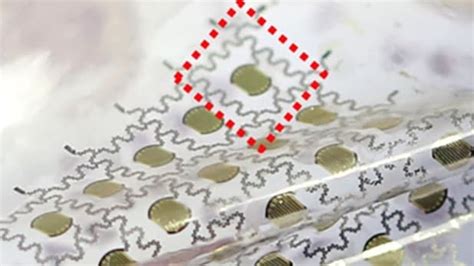 Implantable Sensor Could Measure Bodily Functions And Safely Biodegrade Medical Design Briefs