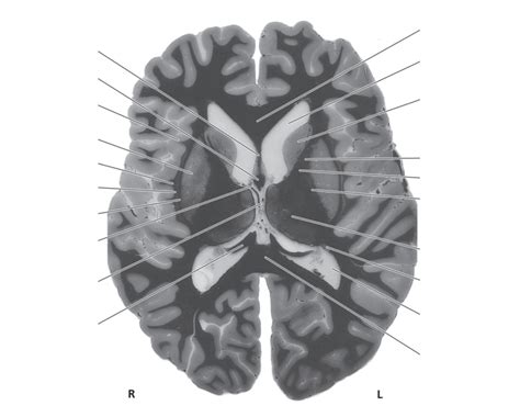 Axial Diagram Quizlet