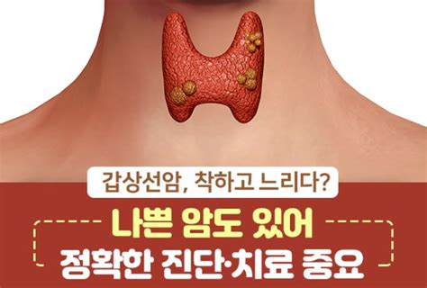 갑상선의 악성 종양 1 갑상선암 Thyroid Cancer 발병 빈도 종류 관련된 유전자 진단 검사법 예후 인자 병기 Ajcc 8판 Stage