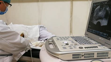 前列腺癌 腹腔镜前列腺癌根治术 原创 治疗