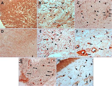Immunohistochemical Localization Of Notch Intracellular Domain Nicd